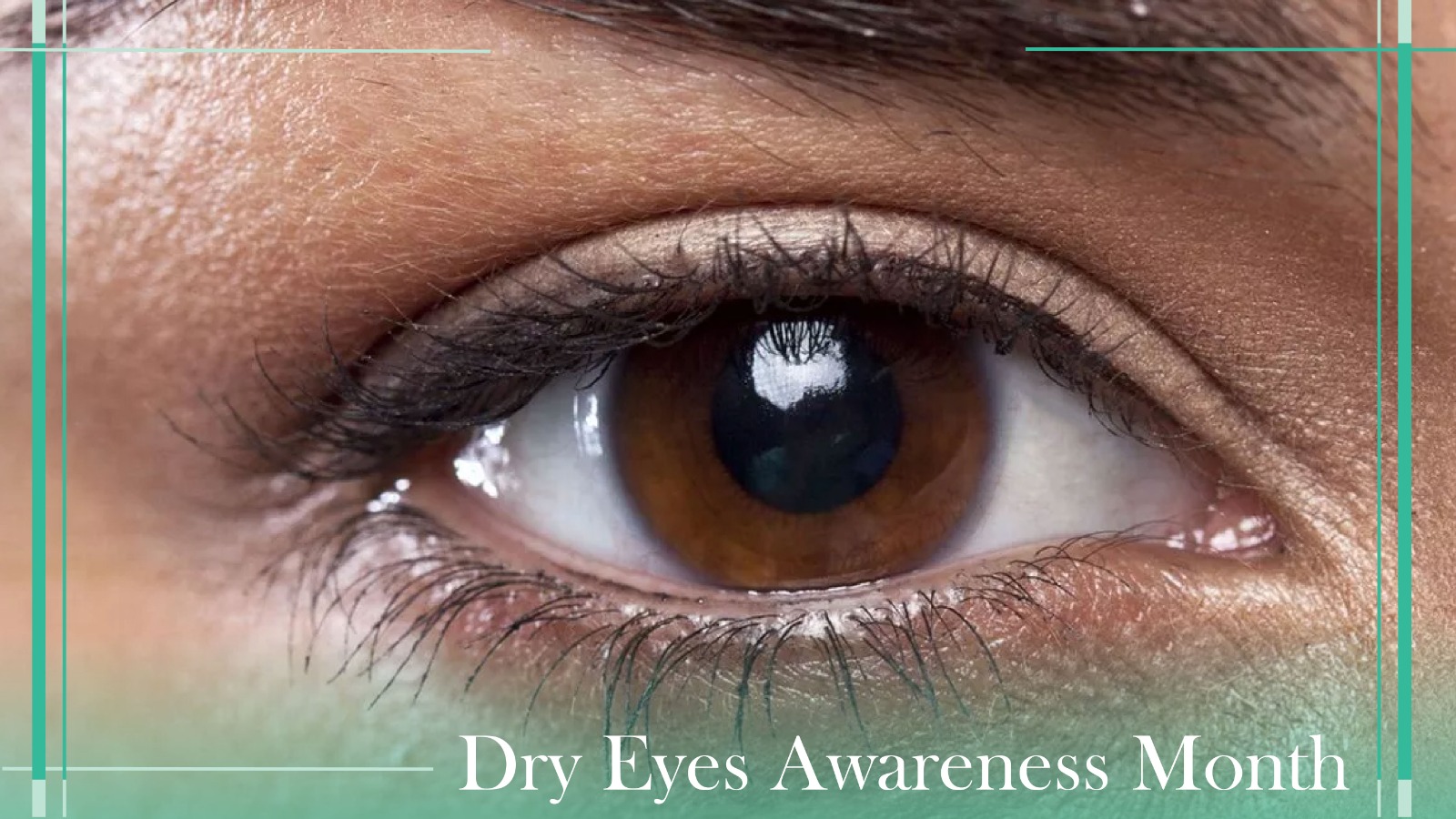 Dry Eyes Awareness Month: Bringing Attention to Dry Eyes This July ...